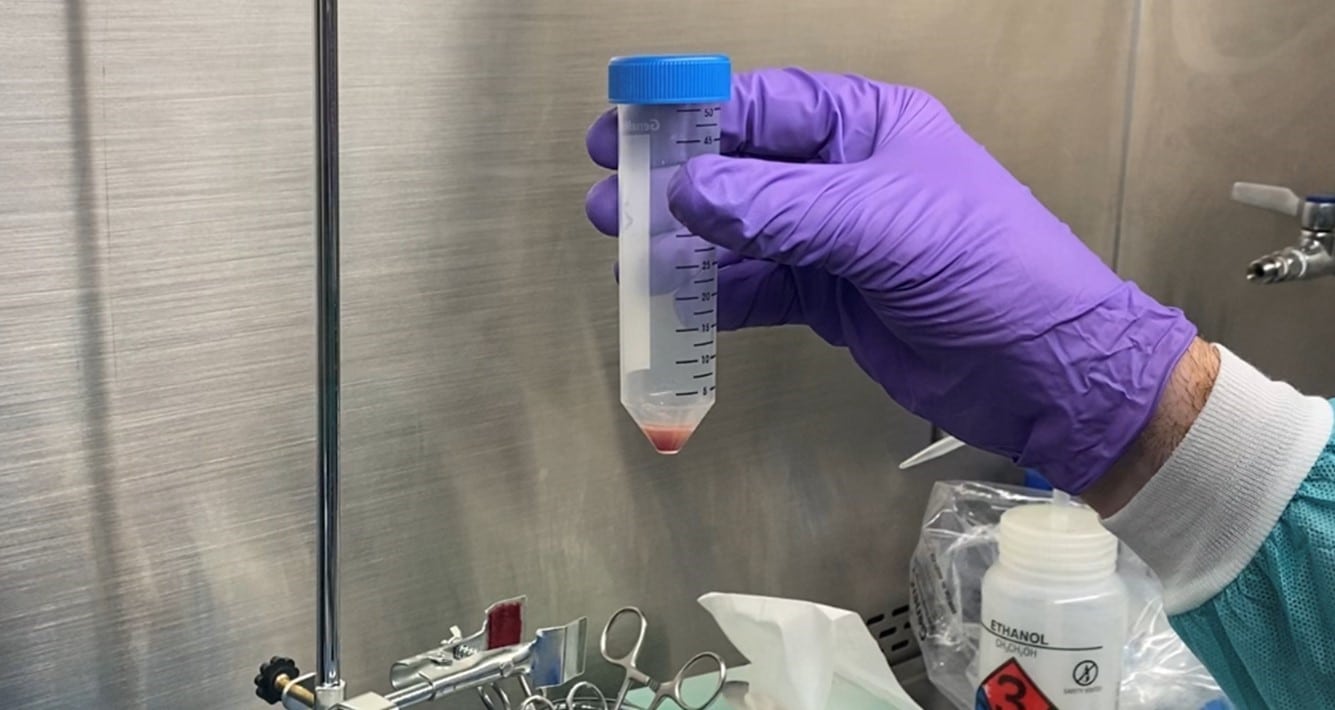 PBMC Pellets Essential Tool For Immunology Research Cytologics PBMC Pellets Essential Tool For Immunology Research Cytologics